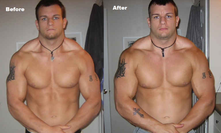 Superdrol (Methasterone): The Final Information - foppa.casa