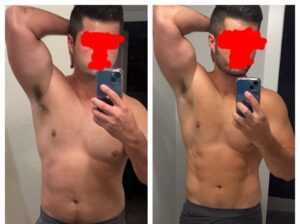 Trenbolone: Anxiety, Depression, Cardiovascular Effects, and More